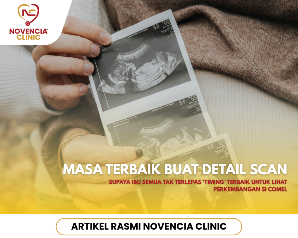 Masa Terbaik Buat Detail Scan? – Novencia Clinic